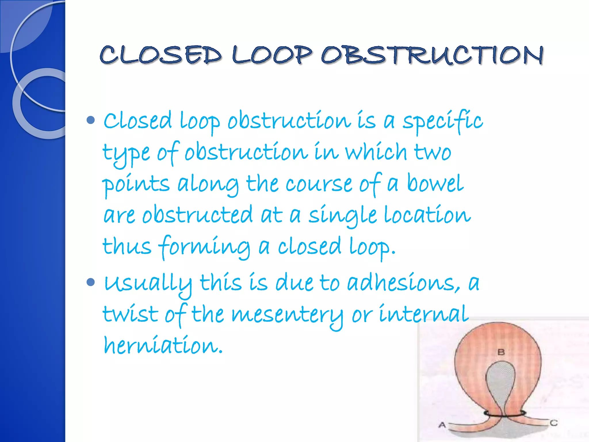 bowelobstruction-150506054437-conversion-gate02.pdf