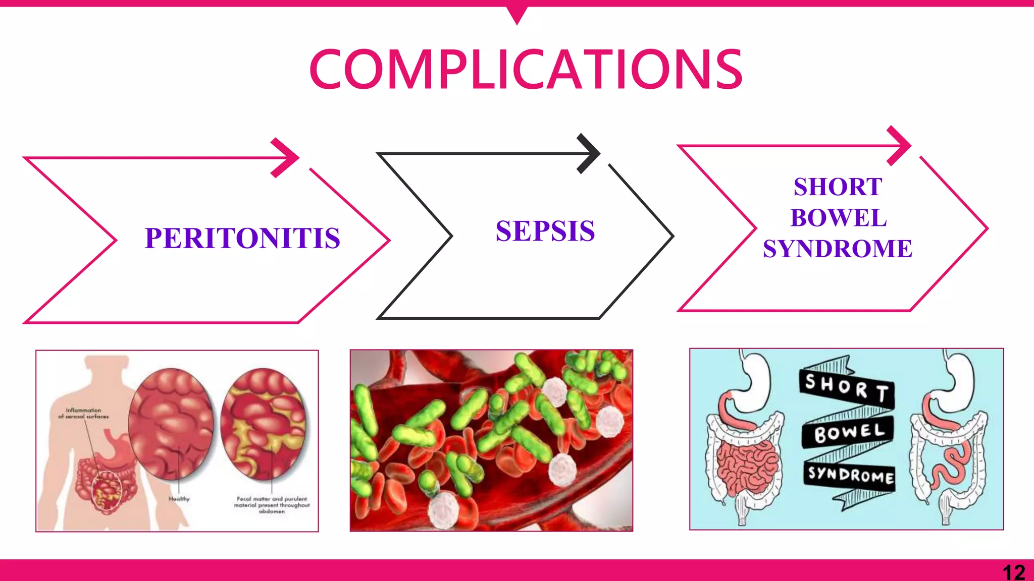 BOWEL OBSTRUCTION.pptx
