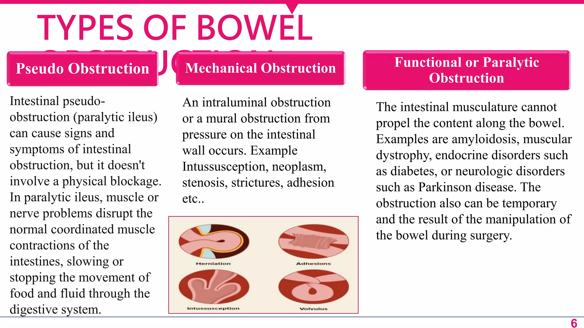 BOWEL OBSTRUCTION.pptx