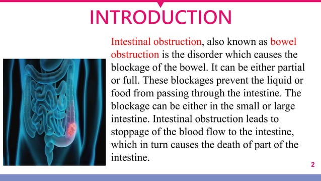 BOWEL OBSTRUCTION.pptx | Digestive Disorders | Diseases and Conditions