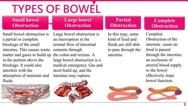 BOWEL OBSTRUCTION.pptx | Digestive Disorders | Diseases and Conditions