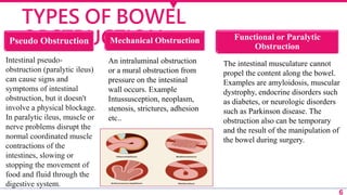 BOWEL OBSTRUCTION.pptx