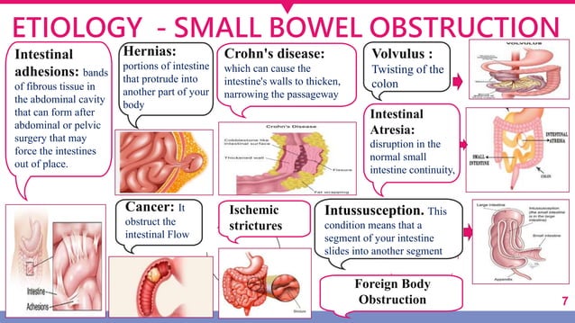BOWEL OBSTRUCTION.pptx | Digestive Disorders | Diseases and Conditions