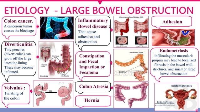 BOWEL OBSTRUCTION.pptx | Digestive Disorders | Diseases and Conditions