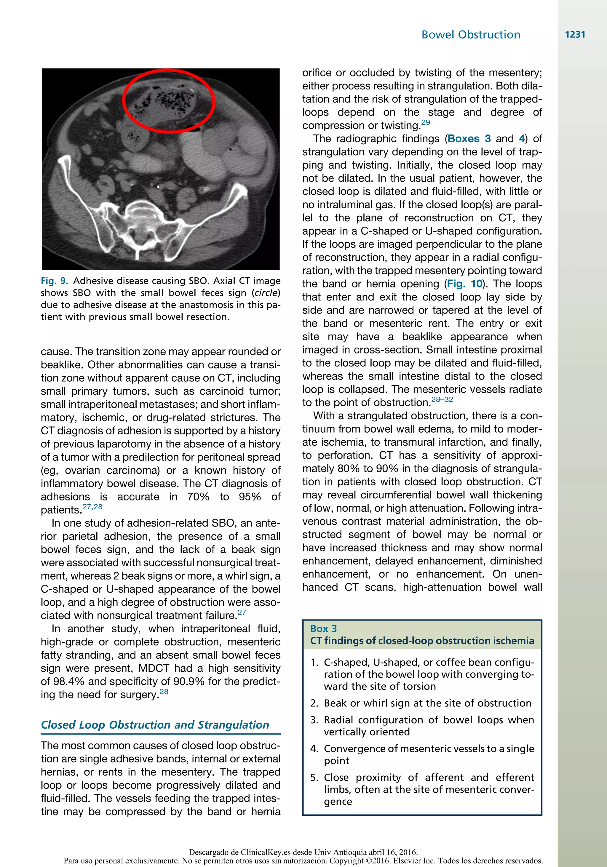Bowel obstruction - Radiology Clinics 2015 | PDF