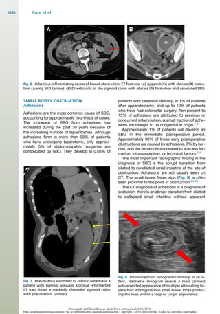 Bowel obstruction - Radiology Clinics 2015 | PDF