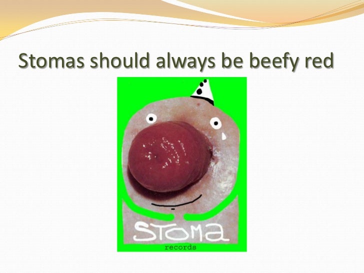 Bowel obstruction colorectal ca