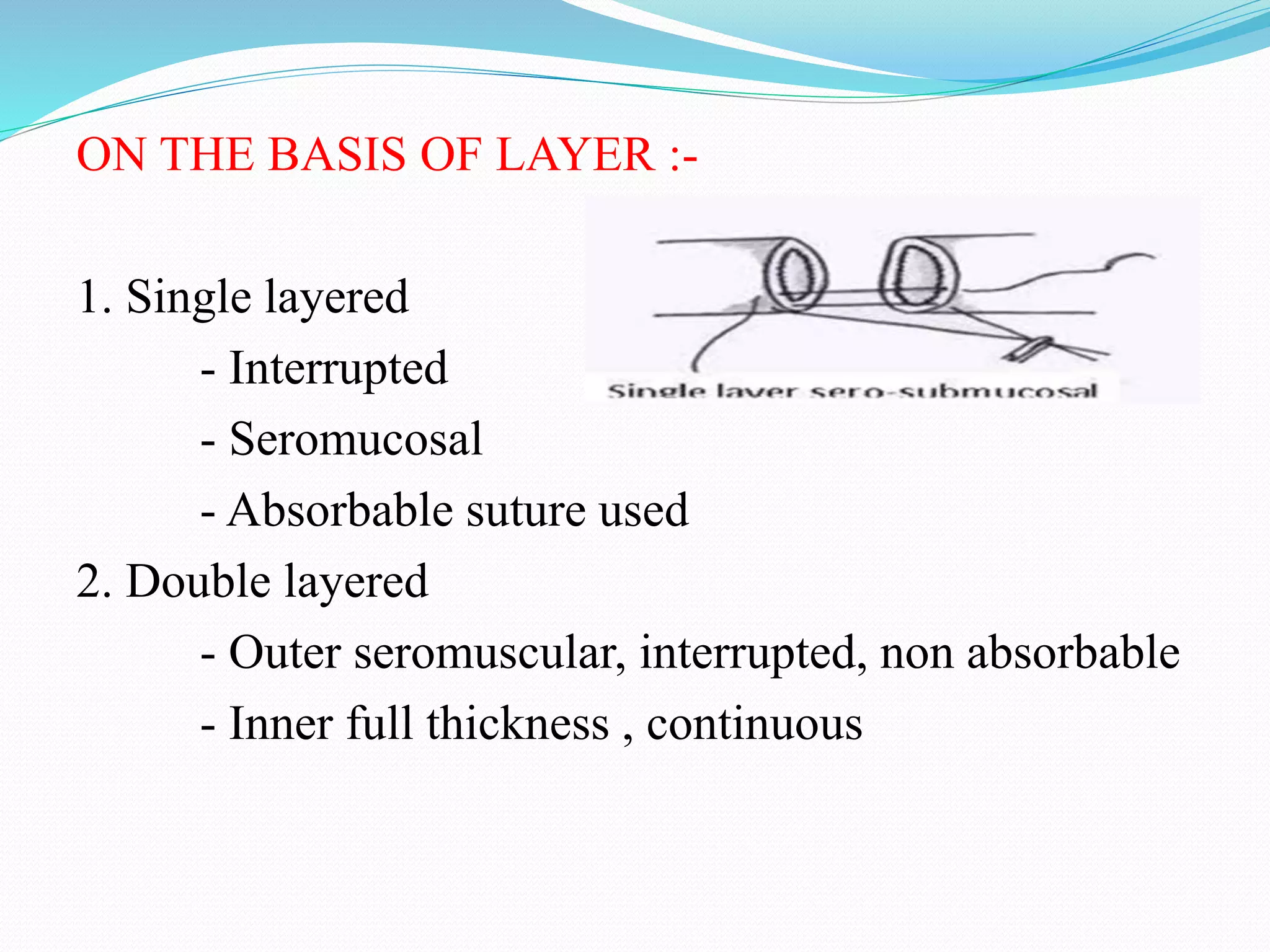 Bowel resection and anastomosis | PPTX