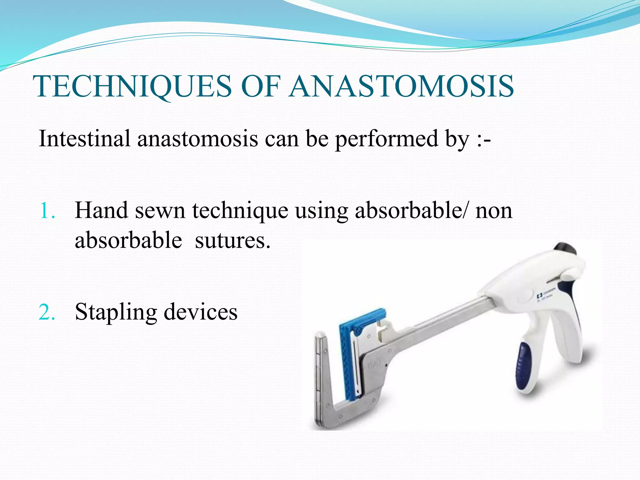 Bowel resection and anastomosis | PPTX