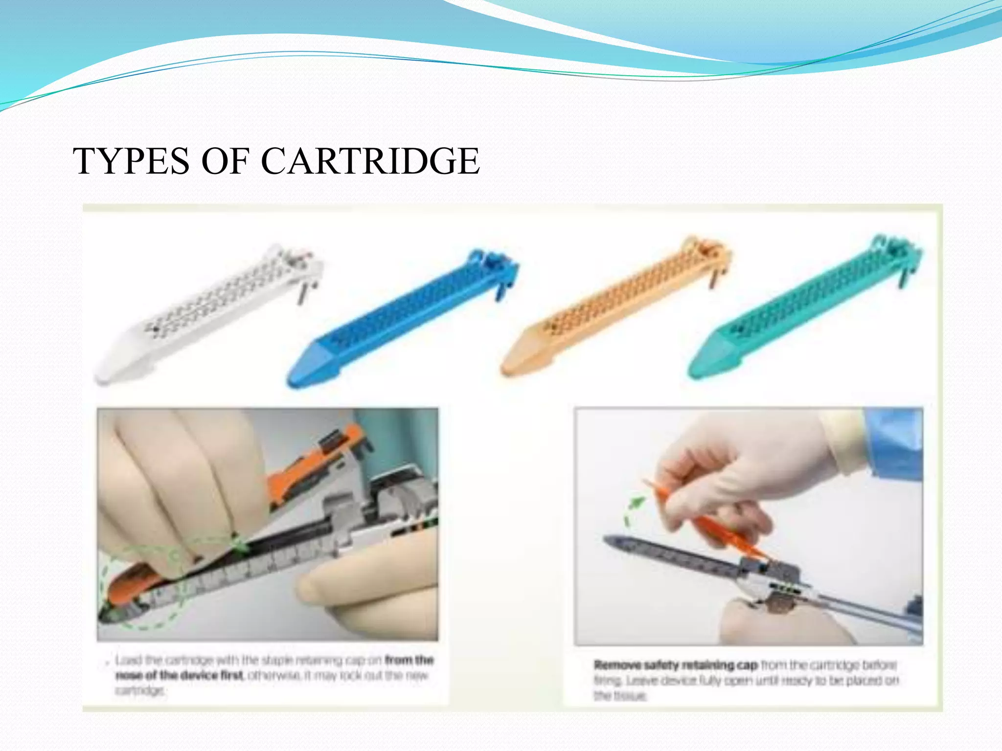 Bowel resection and anastomosis | PPTX