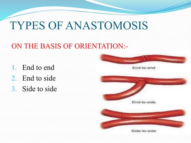 Bowel resection and anastomosis | PPTX