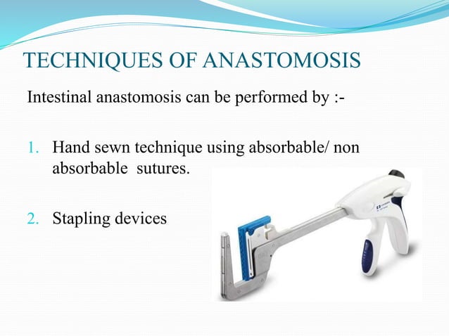 Bowel resection and anastomosis | PPTX