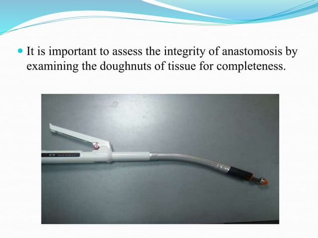 Bowel resection and anastomosis | PPTX