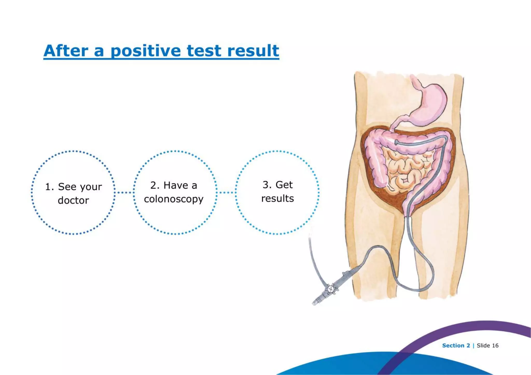 Bowel screening flipchart - English | PPTX