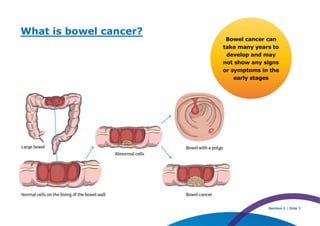 Bowel screening flipchart - English | PPTX