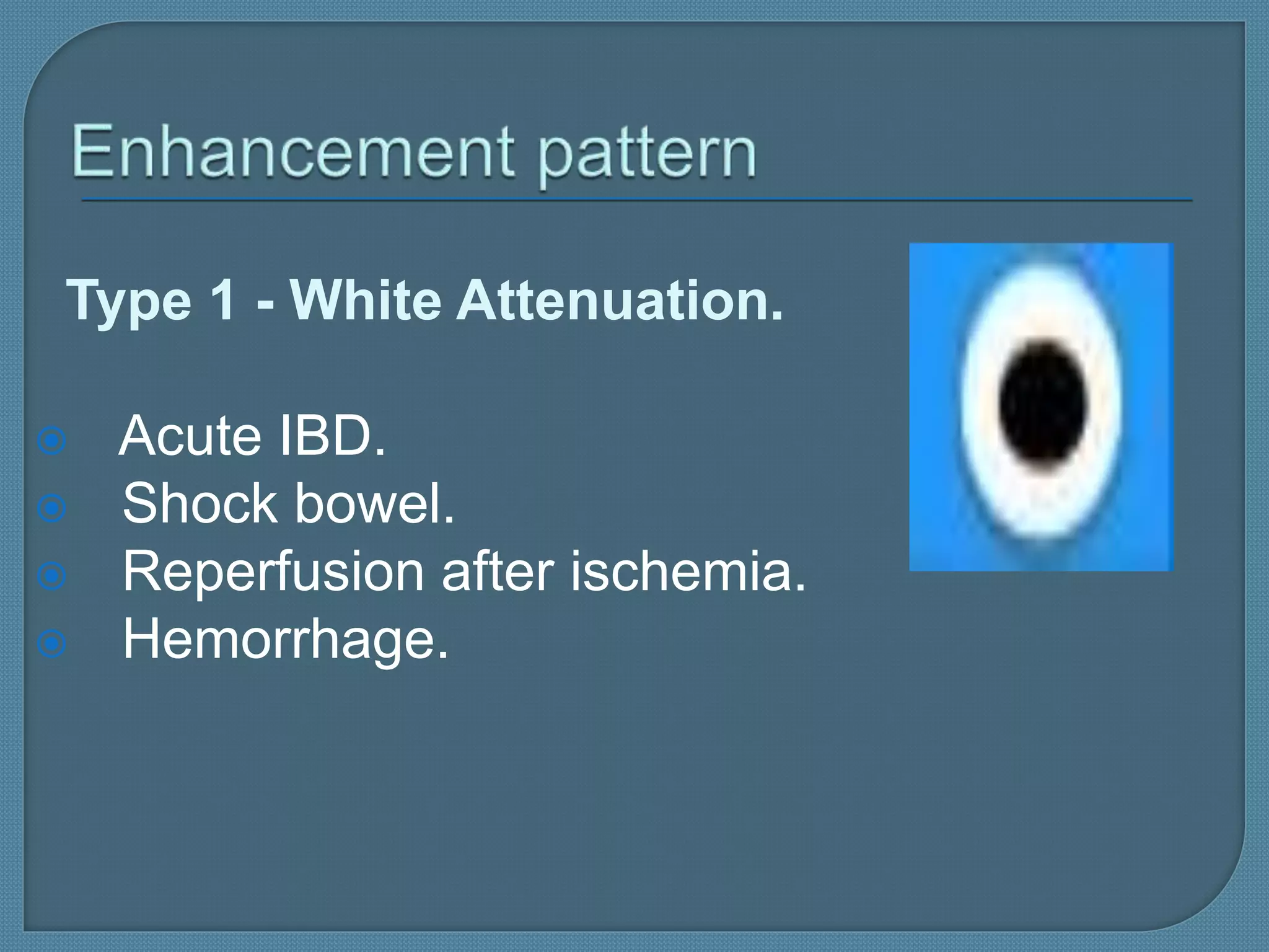 Bowel Wall Thickening CT Pattern | PPTX