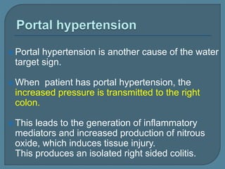 Bowel Wall Thickening CT Pattern | PPTX