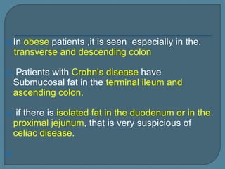Bowel Wall Thickening CT Pattern | PPTX