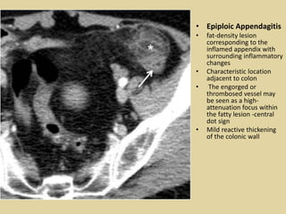 Bowel wall thickening at ct | PPTX