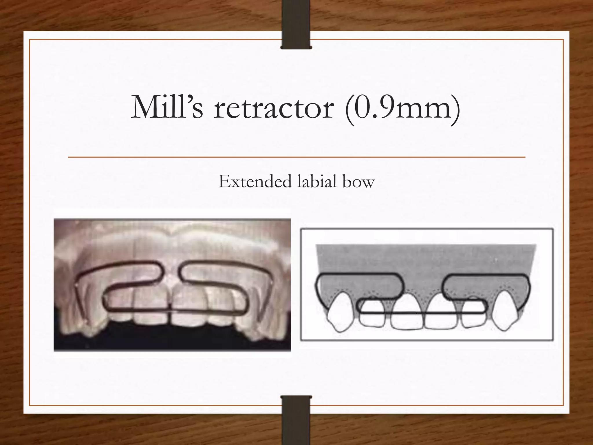 Bows and retractors for Undergraduates | PPTX