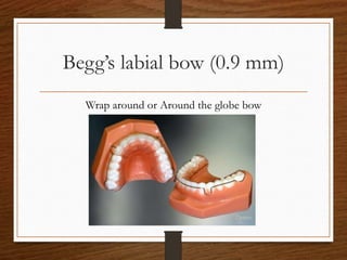 Bows and retractors for Undergraduates | PPTX