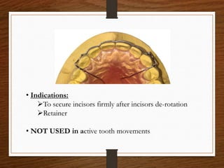 Bows and retractors for Undergraduates | PPTX