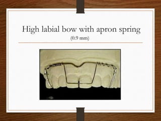 Bows and retractors for Undergraduates | PPTX