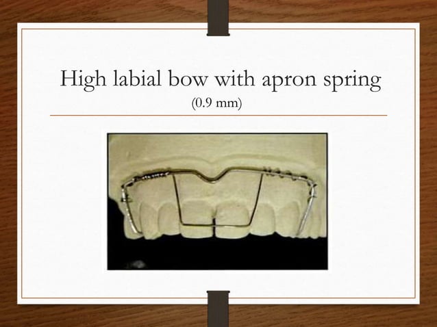 Bows and retractors for Undergraduates | PPTX | Dental Health ...