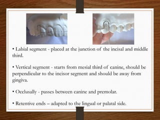 Bows and retractors for Undergraduates | PPTX