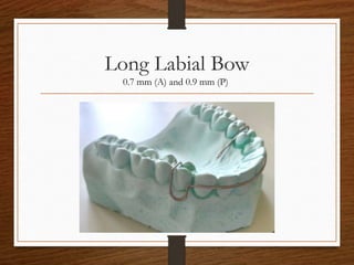 Bows and retractors for Undergraduates | PPTX