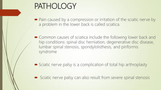 Bowstring test. By Philans Cosmos Ankrah | PPSX