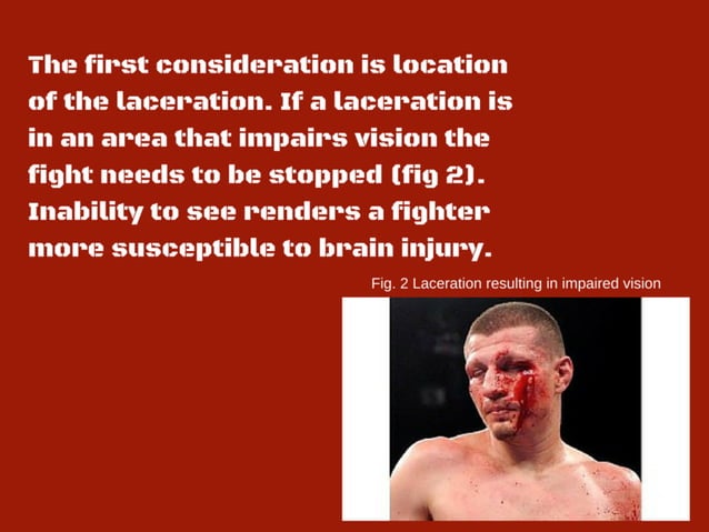 Boxing Injuries: Lacerations | PPT