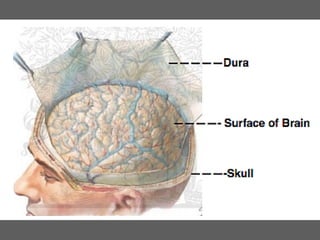 Boxing & the Brain | PPT