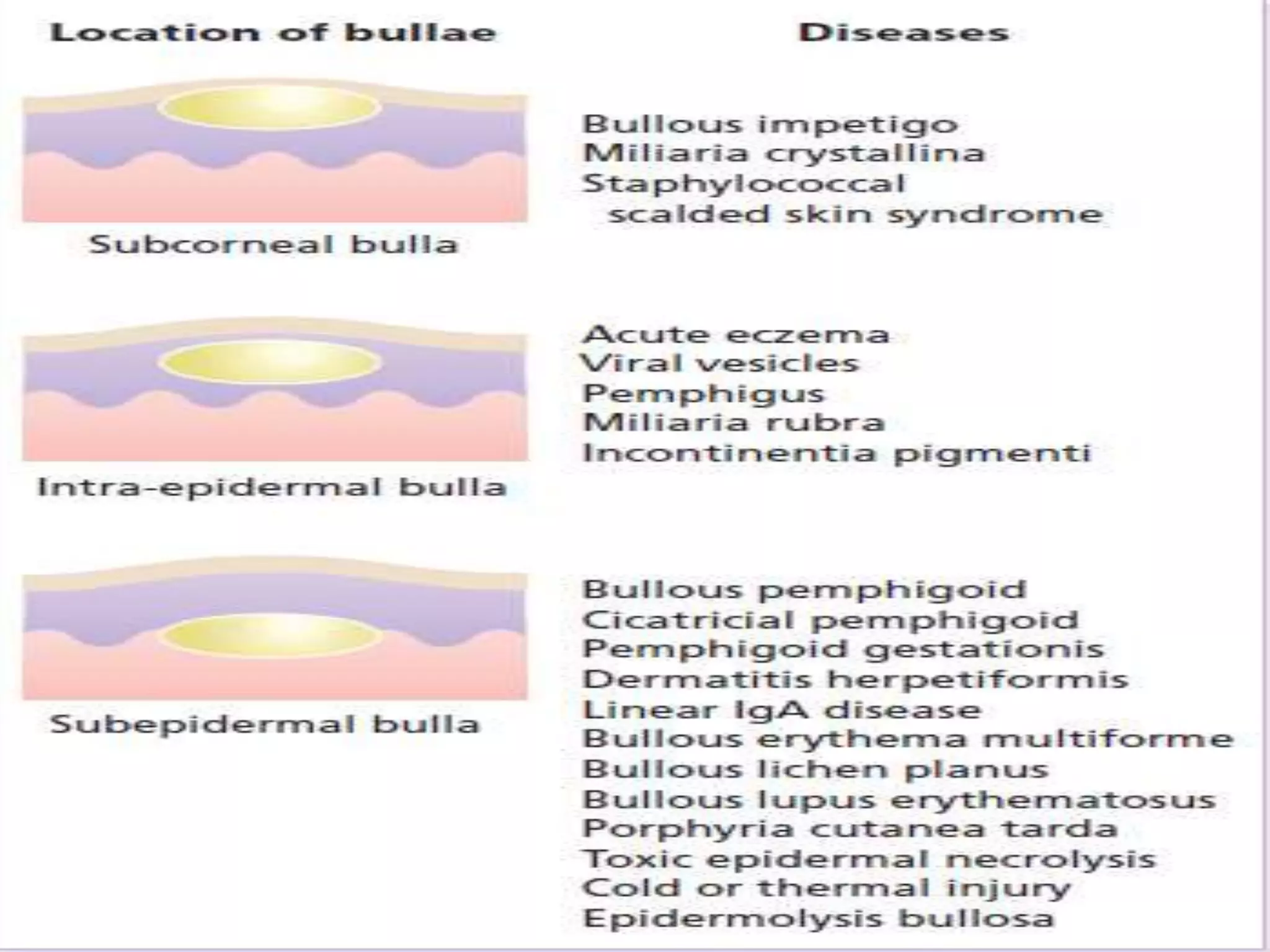 Bullous pemphigoid , dermatitis herpitiformis and cbdc | PPTX
