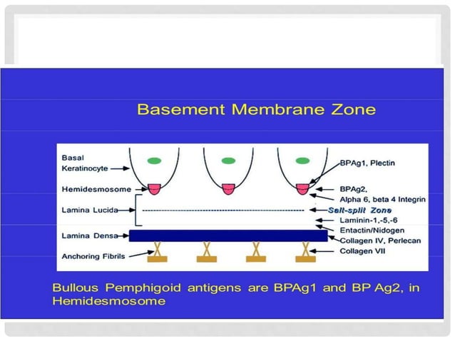 Bullous pemphigoid , dermatitis herpitiformis and cbdc | PPTX | Skin ...