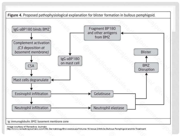 Bullous pemphigoid , dermatitis herpitiformis and cbdc | PPTX | Skin ...