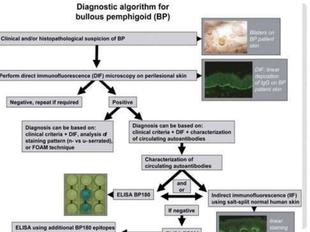 Bullous pemphigoid , dermatitis herpitiformis and cbdc | PPTX | Skin ...