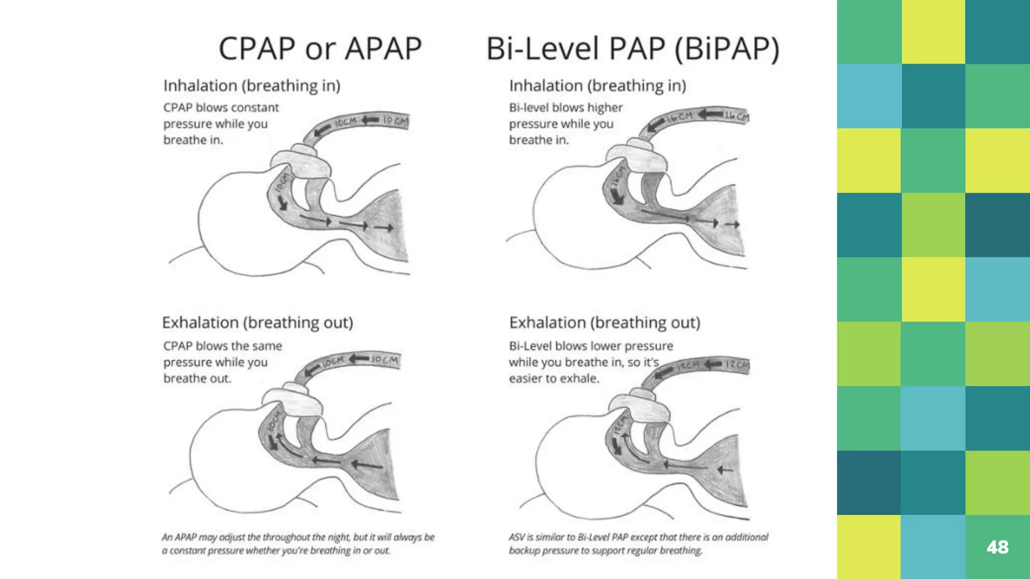 Bpap (bi level positive airway pressure) | PDF