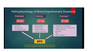 Bronchopulmonary Dysplasia - Chronic complication in preterm babies. | PPTX