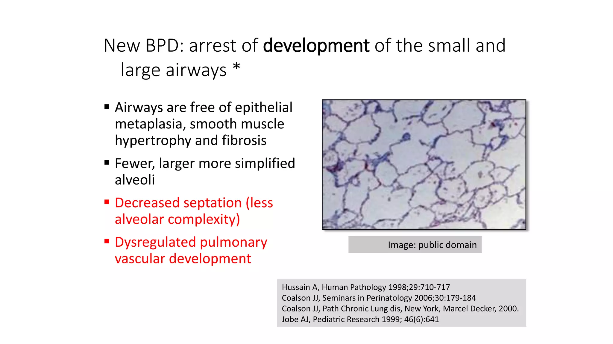 Management of Severe BPD | PPTX
