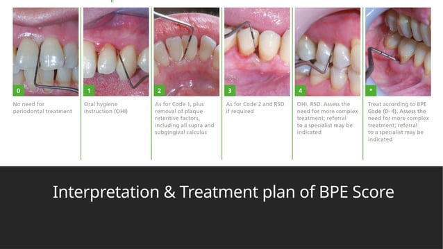 Basic Periodontal Examination classification.pptx
