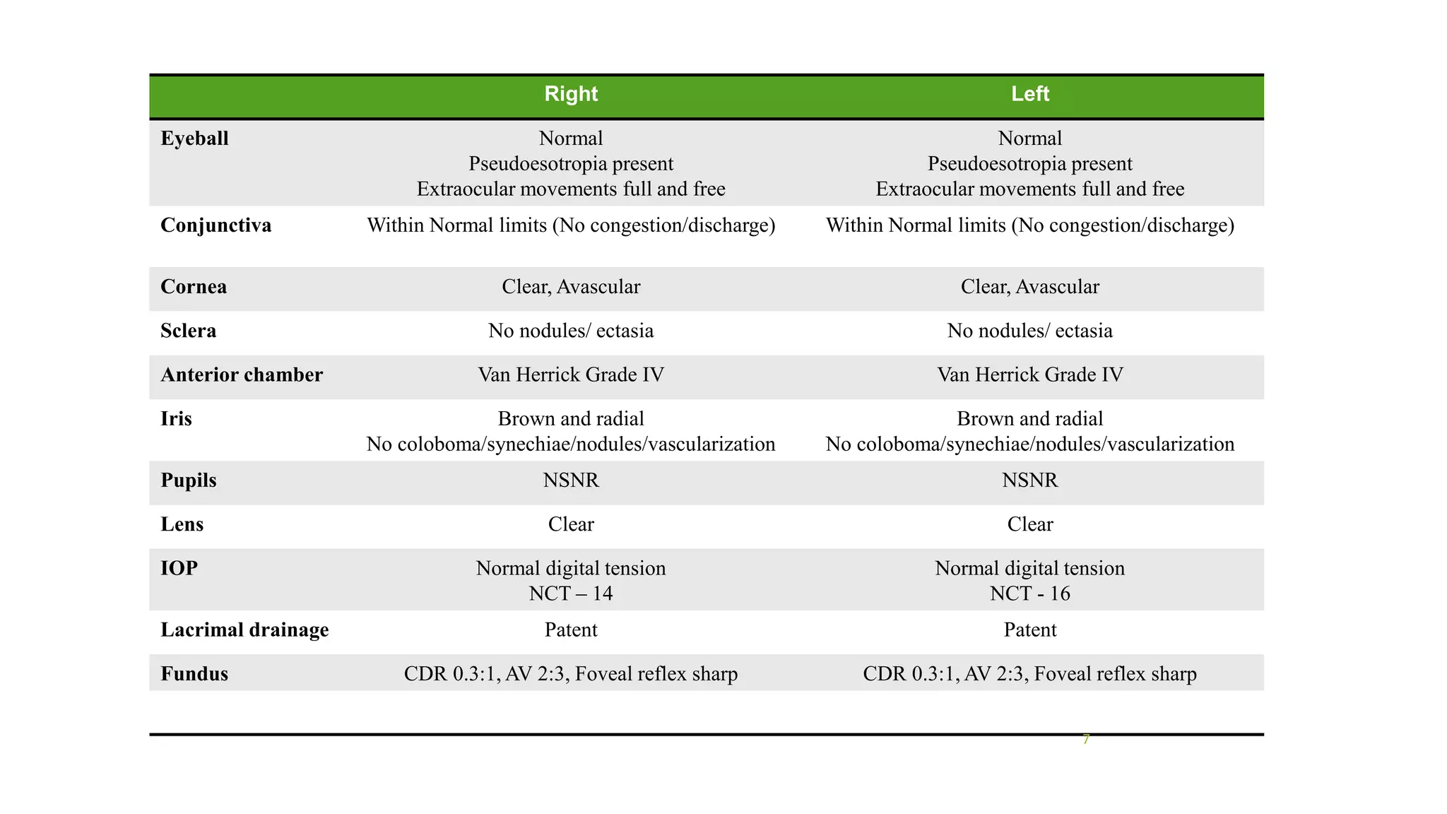 Blepharophimosis Ptosis Epicanthus inversus Syndrome (BPES) | PPTX