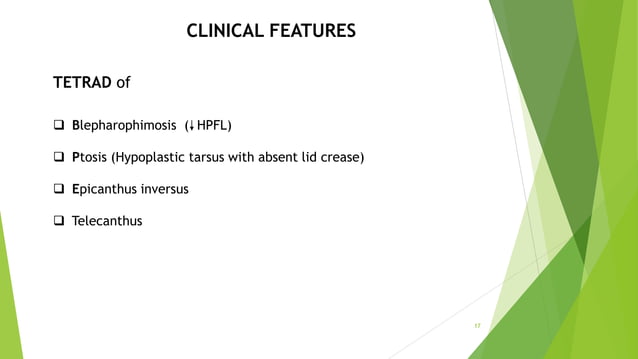 Blepharophimosis Ptosis Epicanthus inversus Syndrome (BPES) | PPTX ...