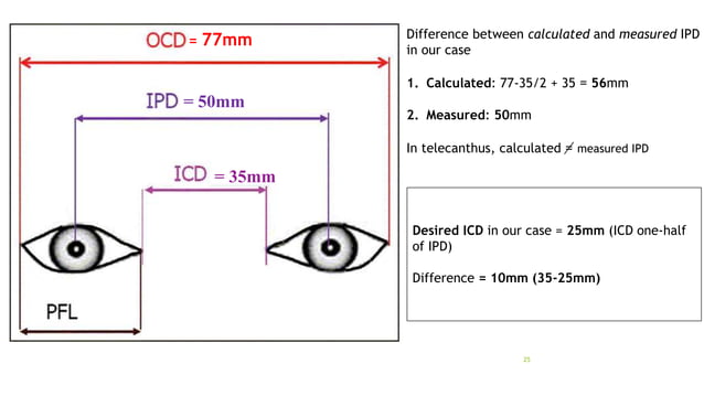 Blepharophimosis Ptosis Epicanthus inversus Syndrome (BPES) | PPTX ...