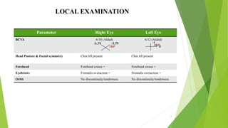 Blepharophimosis Ptosis Epicanthus inversus Syndrome (BPES) | PPTX