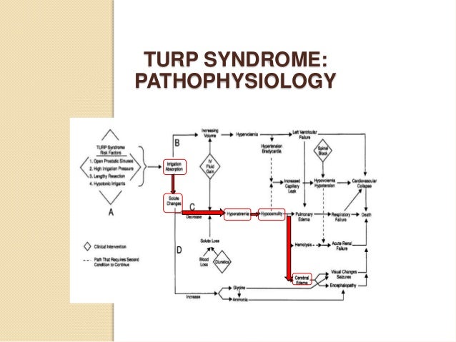 Benign Prostatic Hyperplasia Pathophysiology Diagram
