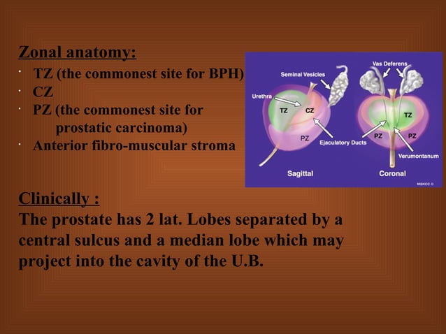 Benign Prostate Hyperplasia & Prostate Cancer | PPT