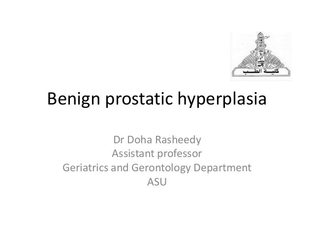 BENIGN PROSTATIC HYPERPLASIA | PPTX | Sexual Conditions | Sexual Health