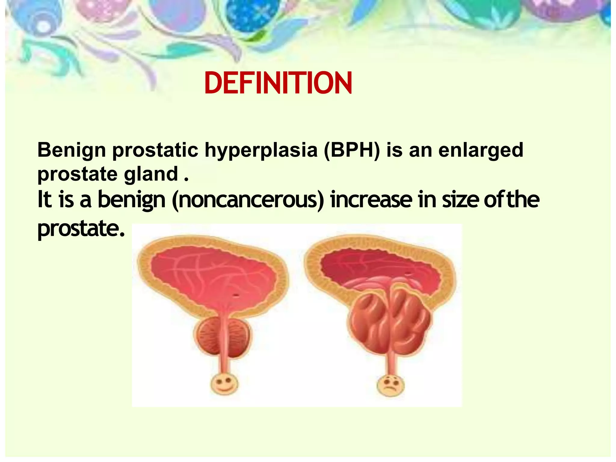 Benign Prostate Hyperplasia | PPTX