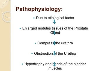 Benign Prostatic Hyperplasia Pathophysiology